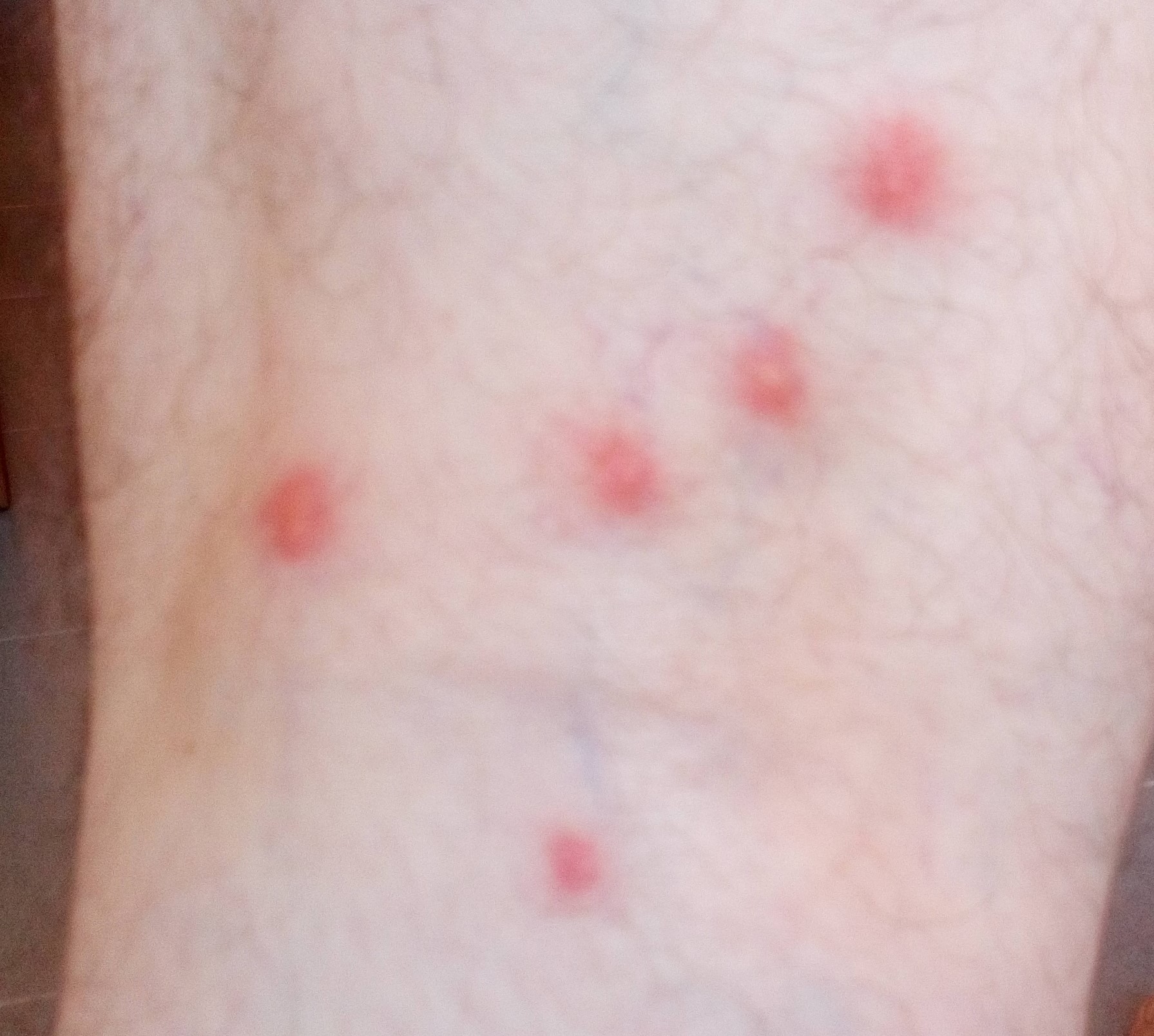 Holiday notes: sun, sea, sand, and insect bites – The Compartments